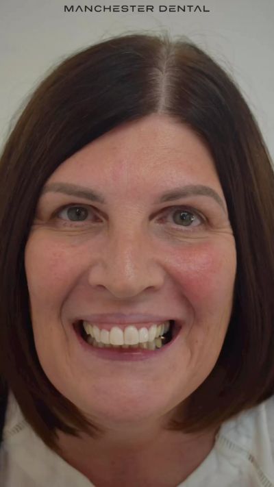 Smile Gallery - Manchester Dental