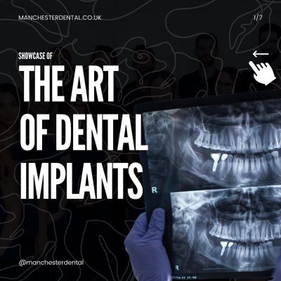 Smile Gallery - Manchester Dental